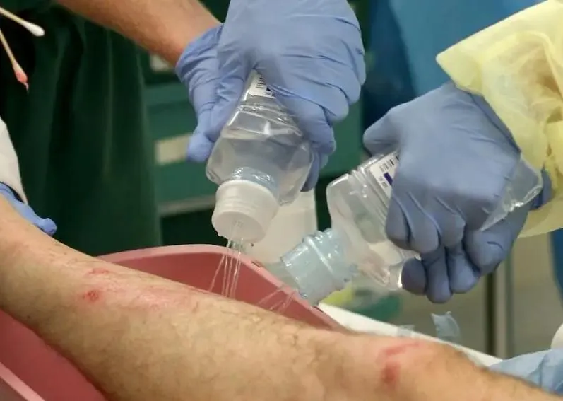 When Assisting With Wound Irrigation, What PPE Would Be Required ...